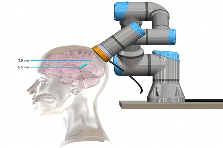 脑盒科技官网 | NeuroFUS经颅聚焦超声刺激仪_NeuroConn经颅电刺激仪_中国总代理